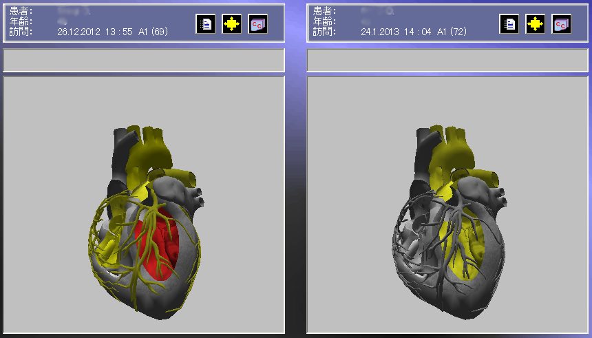 EIS Electro Interstitial Scan - 株式会社ワイズ・テック